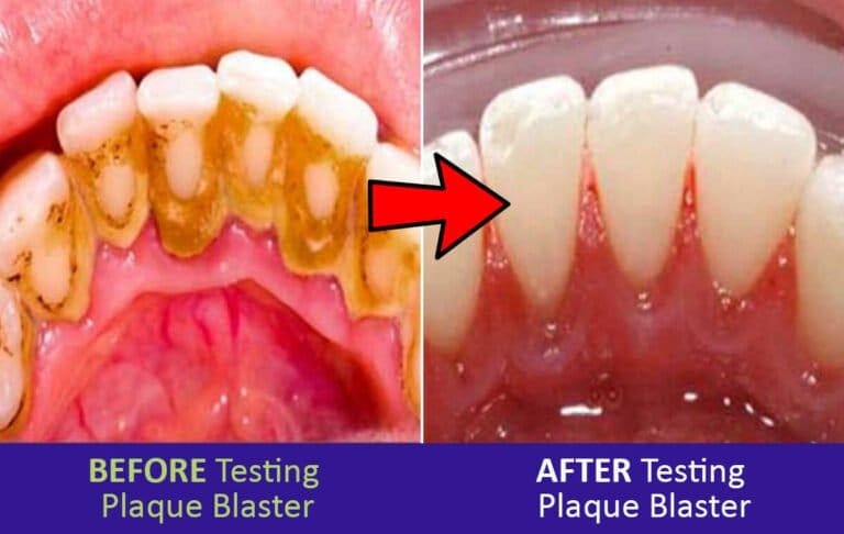 Story PB-GG-CA - Swissklip