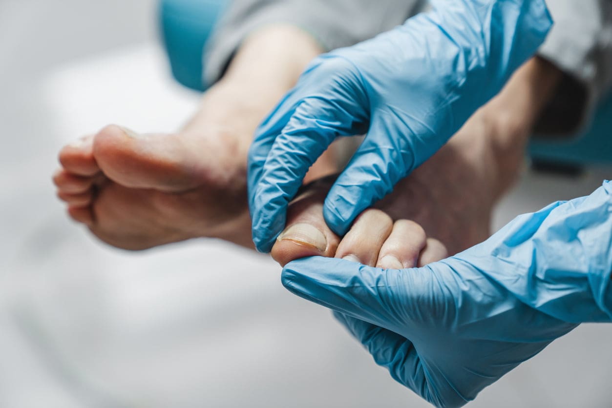 Toenail Cutting for Seniors: In Home or Doctor? - Swissklip