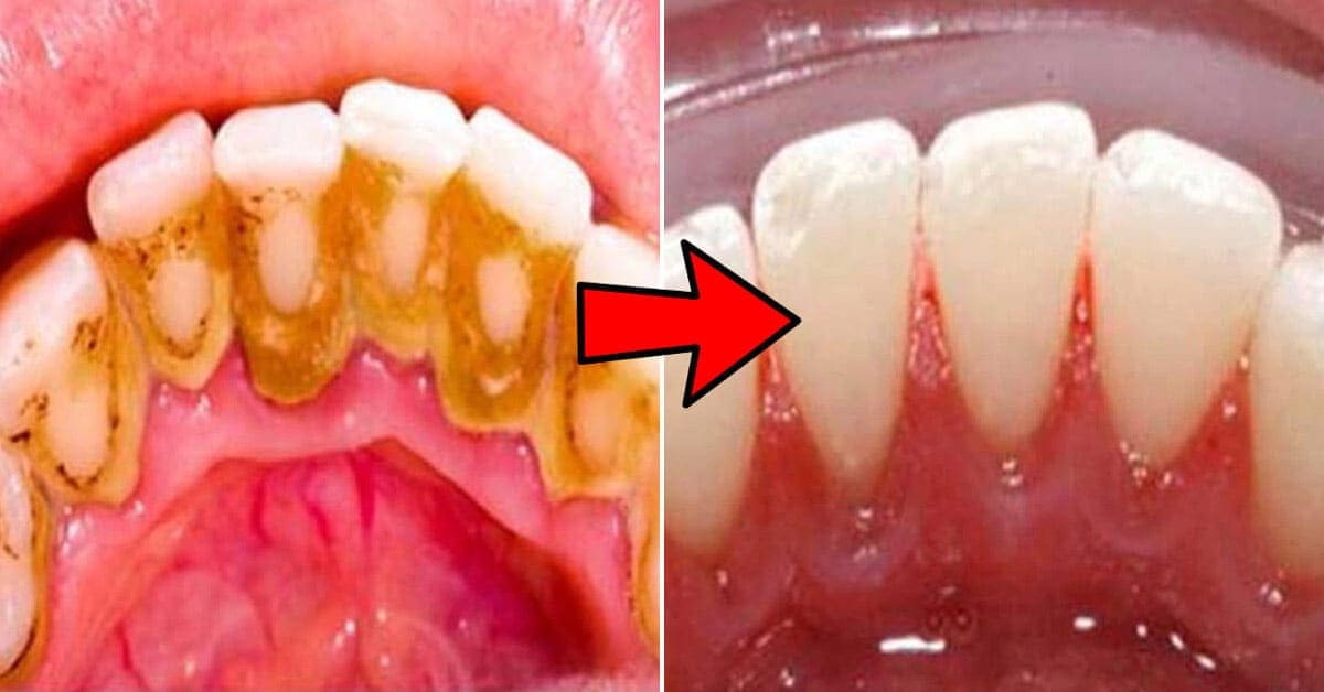 Story PB-GG-STV4-CityB - Swissklip