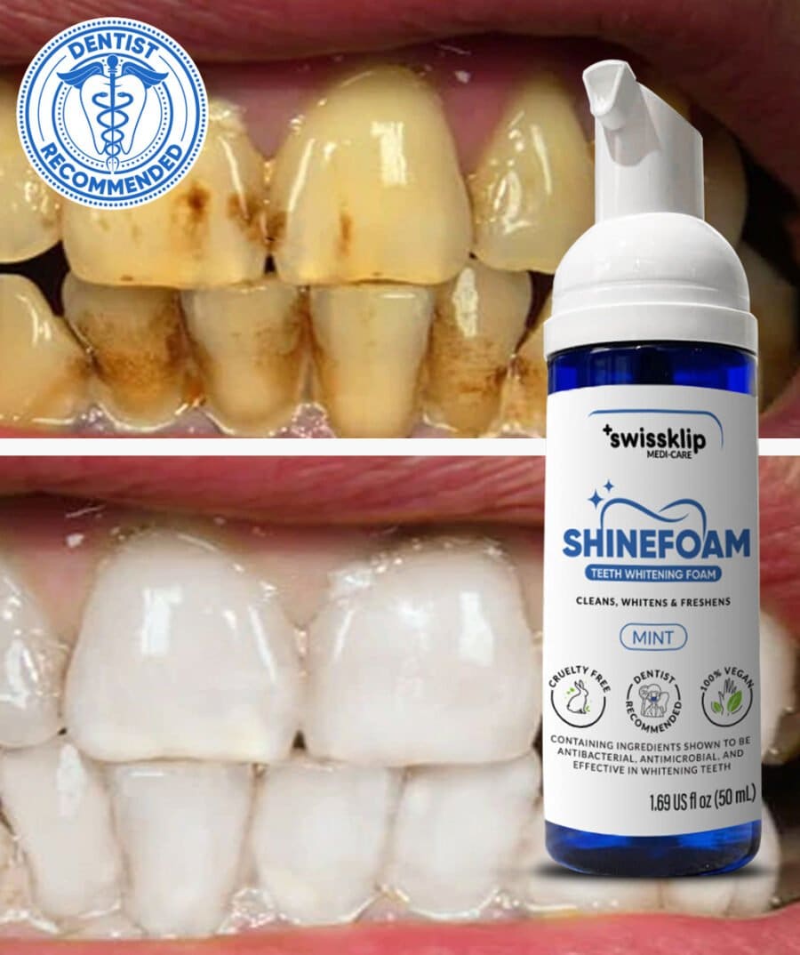 Swissklip Teeth Whitening Foam - Swissklip