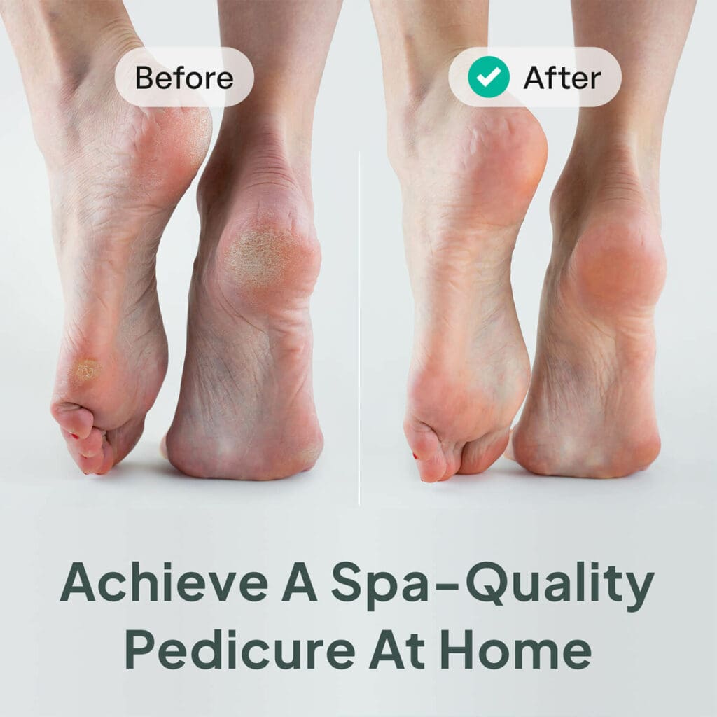 Pain-free Foot Scrubber Callus Remover