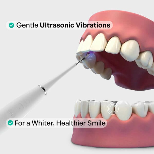 Dentist-approved Plaque Remover for everyday use