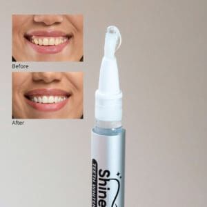 ShinePen | Teeth Whitening Pen - Swissklip